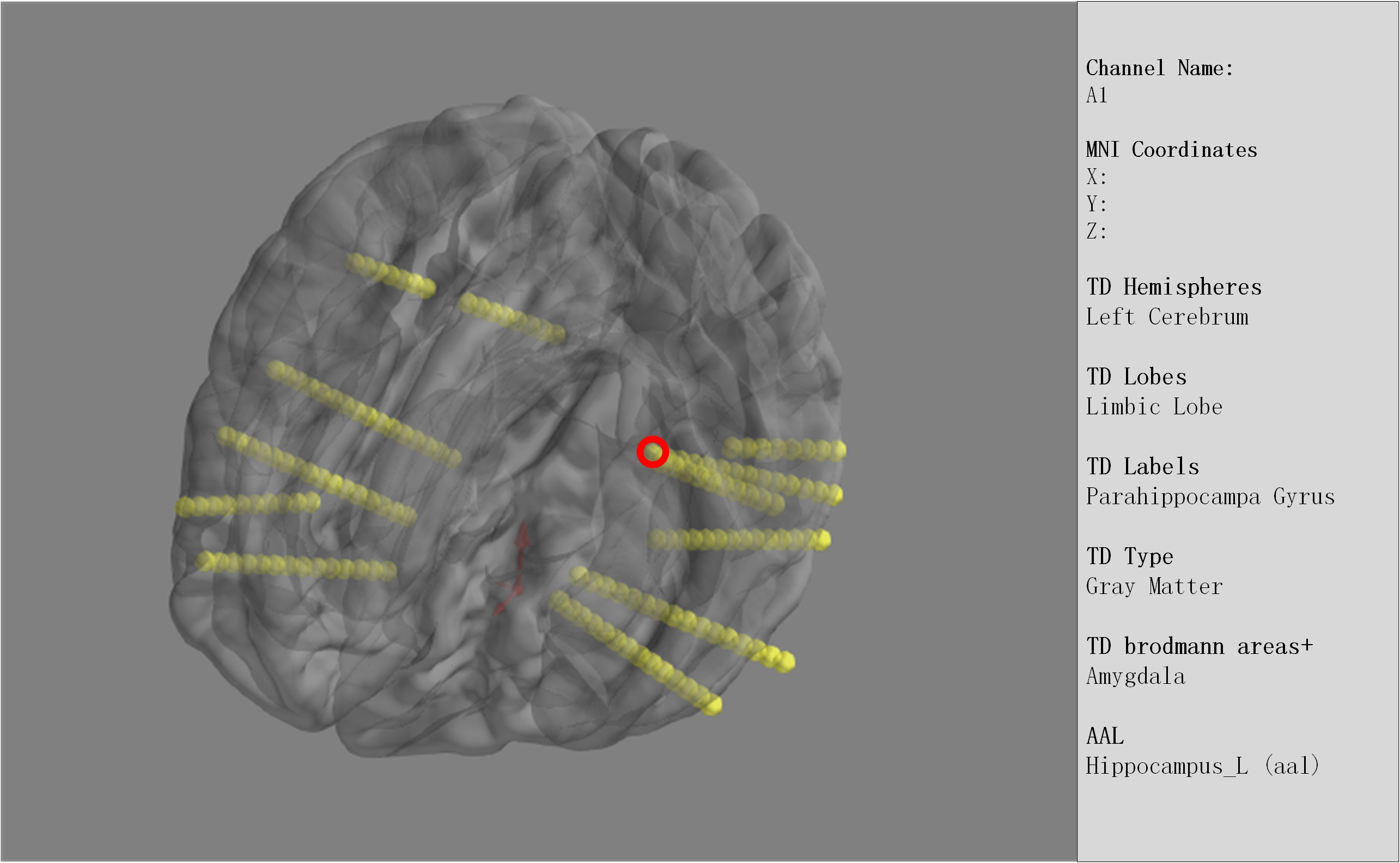 Adding SEEG electrodes's info in 3D · Issue #8593 · mne-tools/mne ...