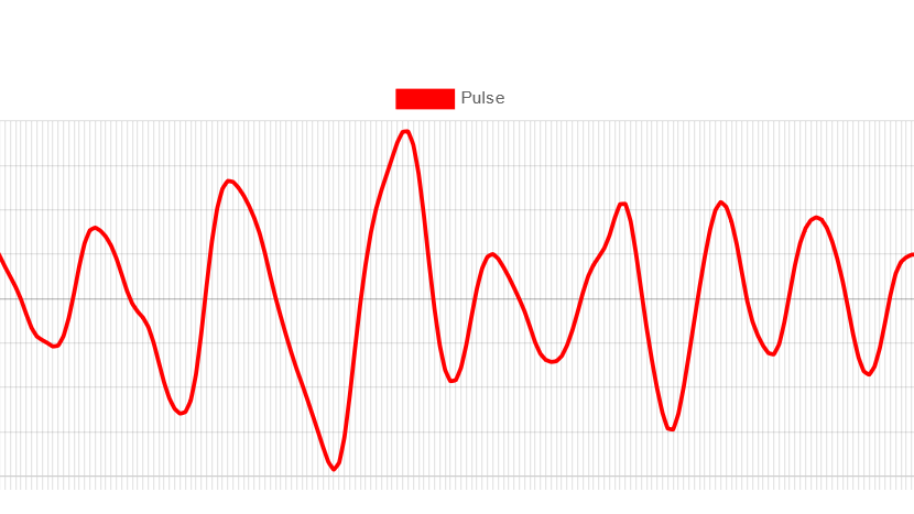 GitHub - A0158/Vitalsigns_Prediction: Realtime Vital Signs Prediction ...