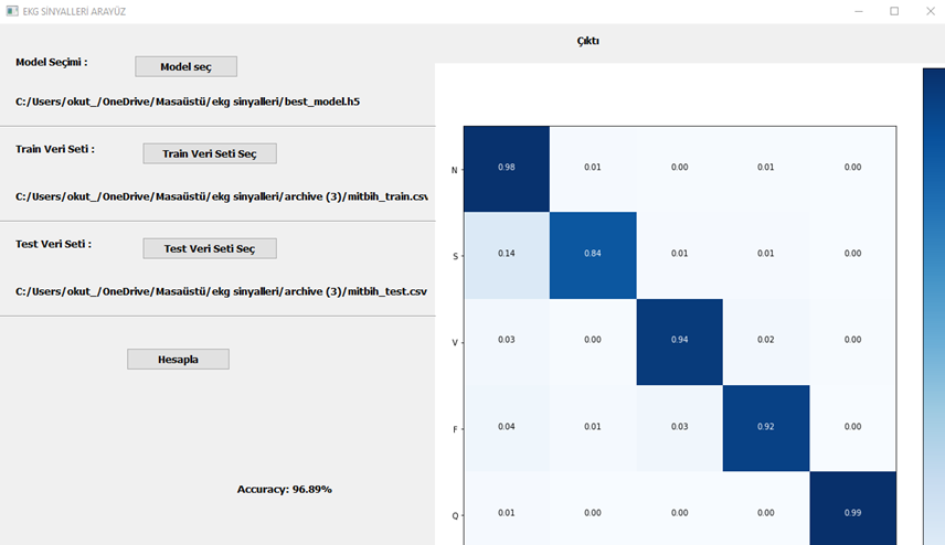 GitHub - ozcannokut/CLASSIFICATION-OF-ECG-SIGNALS-BY-DEEP-LEARNING