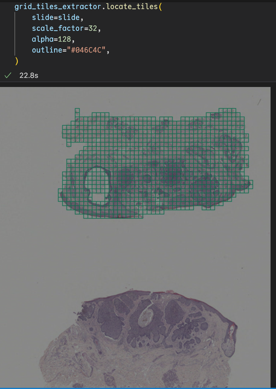 extraction error · Issue #422 · histolab/histolab · GitHub