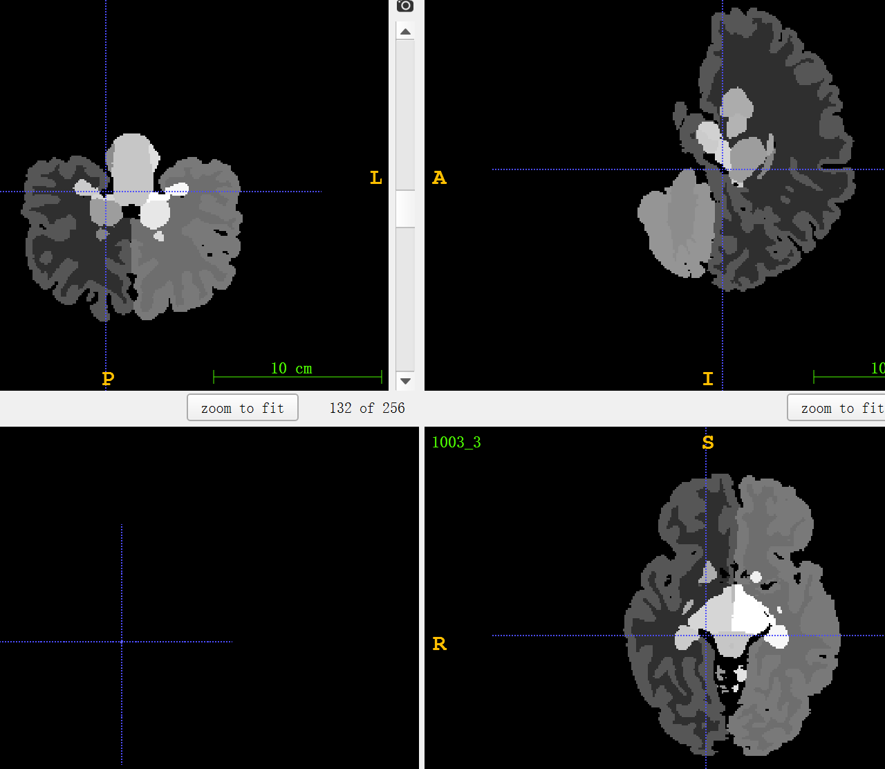 ACEnet issues · Issue #1 · ymli39/ACEnet-for-Neuroanatomy-Segmentation · GitHub