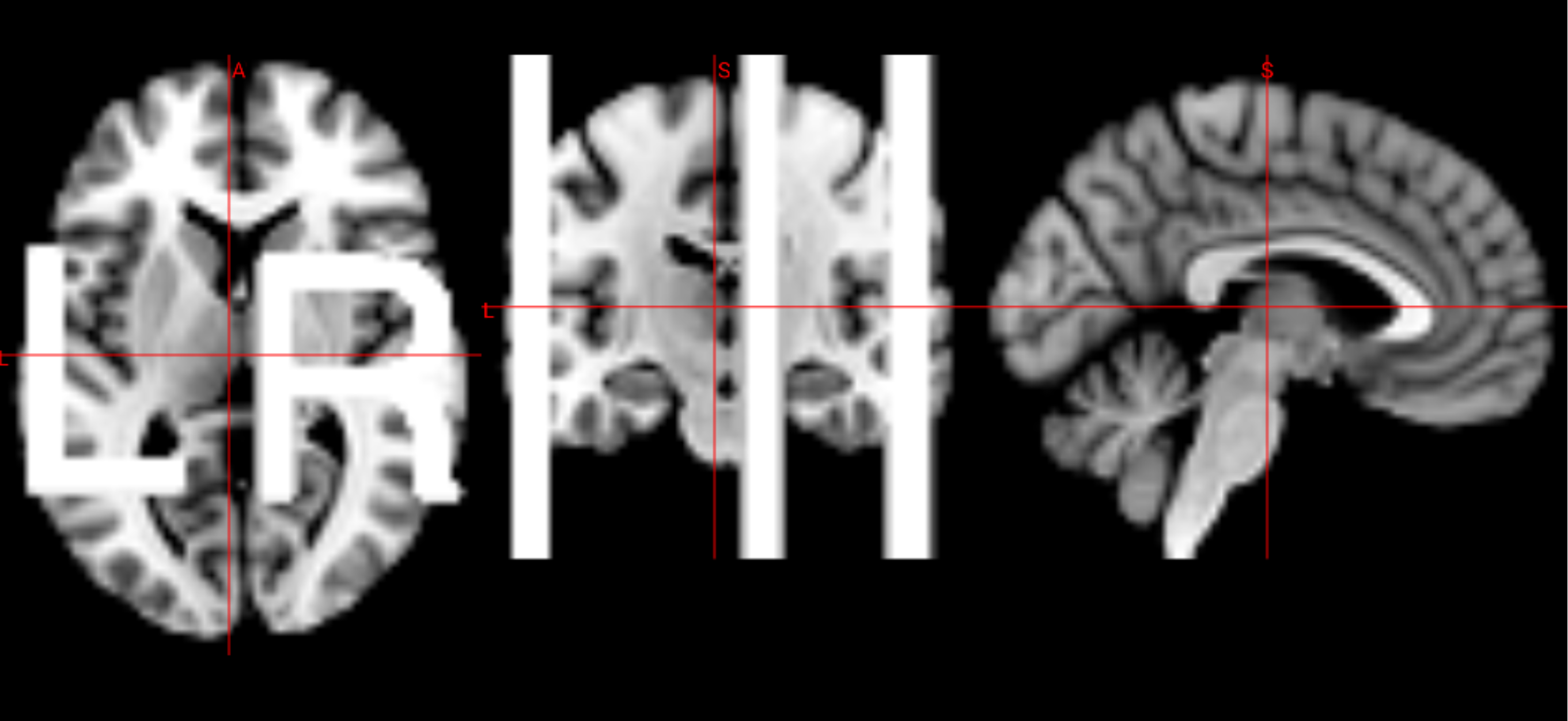 Setting of image orientation radiological/neurological · Issue #201 ...