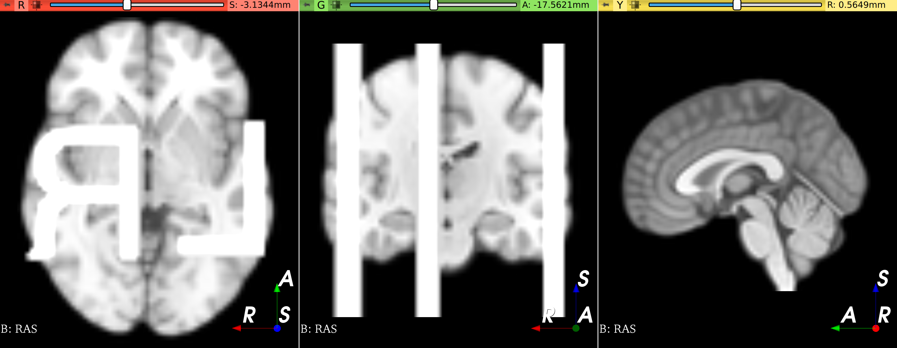 Setting of image orientation radiological/neurological · Issue #201 ...