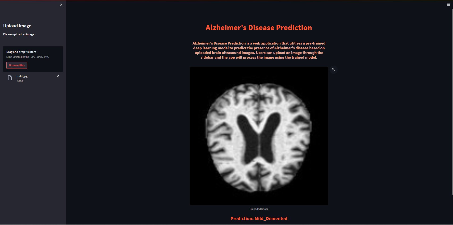 GitHub - Nirmit1910/alzheimers-detection
