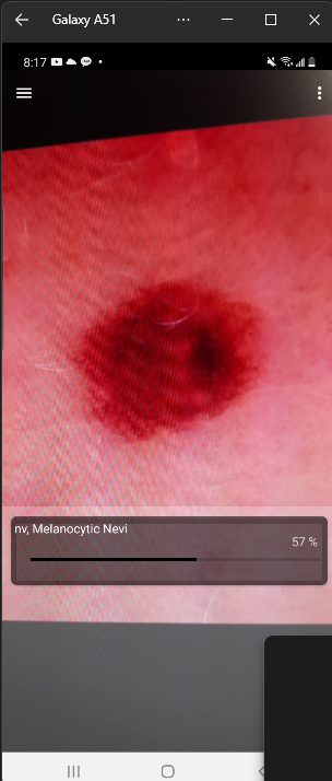 GitHub - yhj3763/skin_cancer_detection