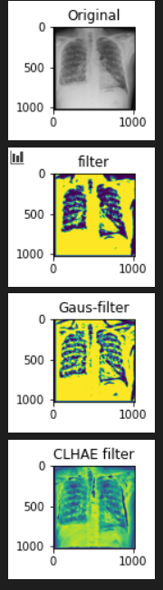 GitHub - Pradeep23-01/XRay-Net: ChestX-ray14-v3 dataset underwent several preprocessing ...