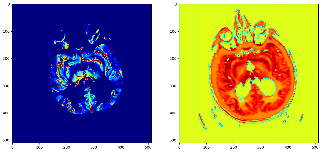 best_model_NLR_CBV.pt · Issue #2 · EIDOSLAB/Neural-Network-derived-perfusion-maps · GitHub