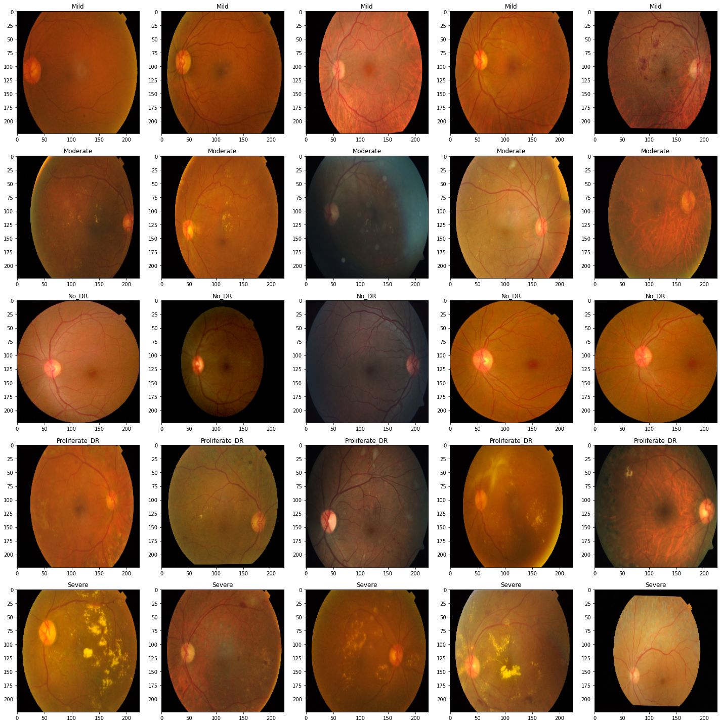 GitHub - praveeshagongura/BlindnessDetectionUsingDeepLearning