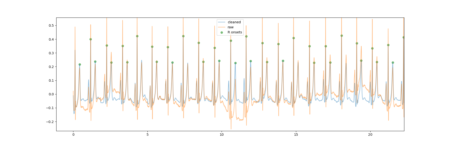 False positive R peaks detected with neurokit method : T onsets ...