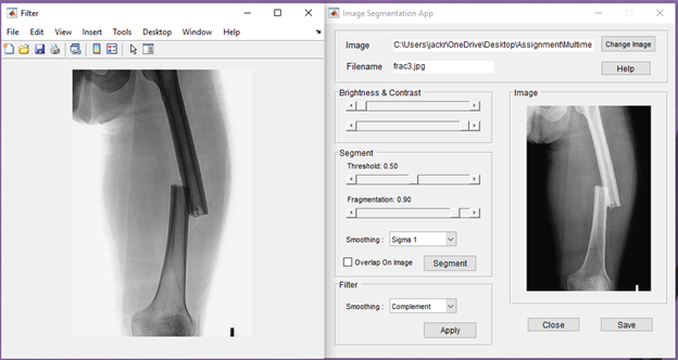 GitHub - Susank-Aryal/Segmentation_Tool: Threshold Segmentation tool build in MATLAB submitted ...