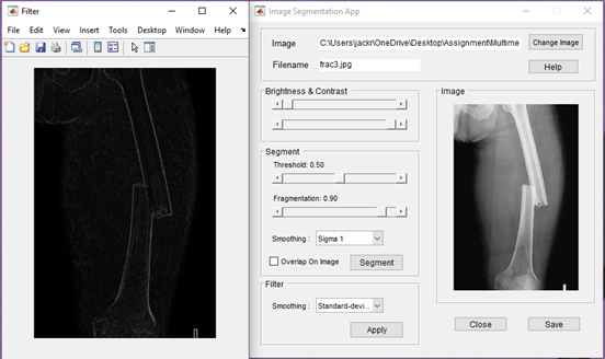 GitHub - Susank-Aryal/Segmentation_Tool: Threshold Segmentation tool ...