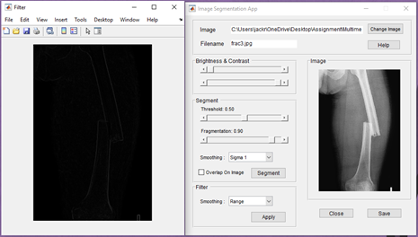 GitHub - Susank-Aryal/Segmentation_Tool: Threshold Segmentation tool ...