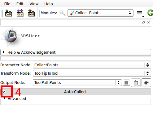 Using the Curve Maker extension · Issue #331 · PlusToolkit/PlusLib · GitHub