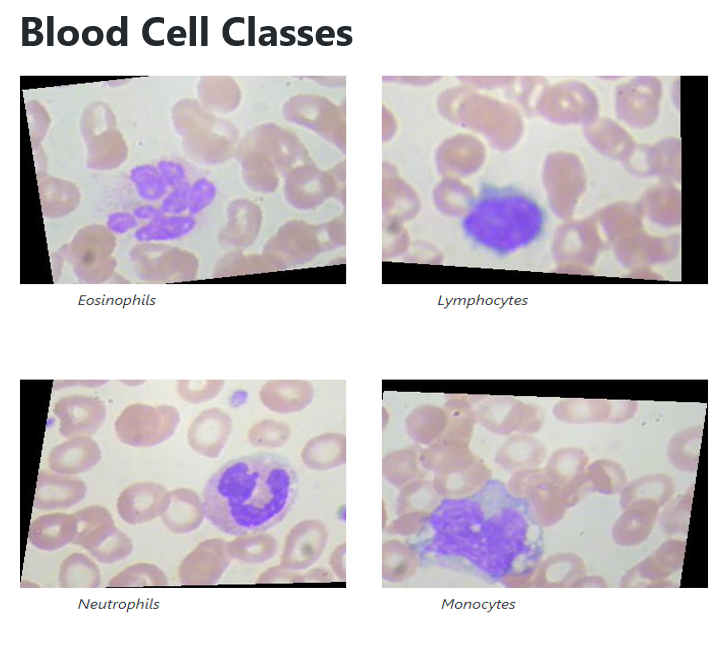 GitHub - Renita1206/Blood-Cell-Image-Classification: PESU IO Deep ...
