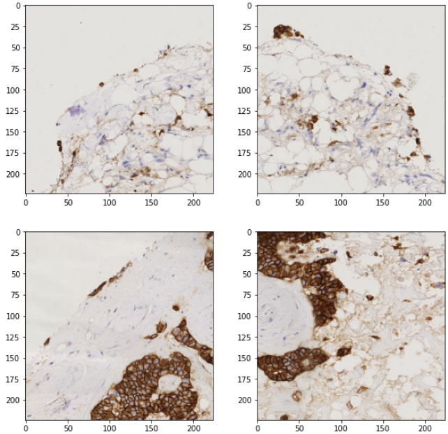GitHub - Surayuth/Her2