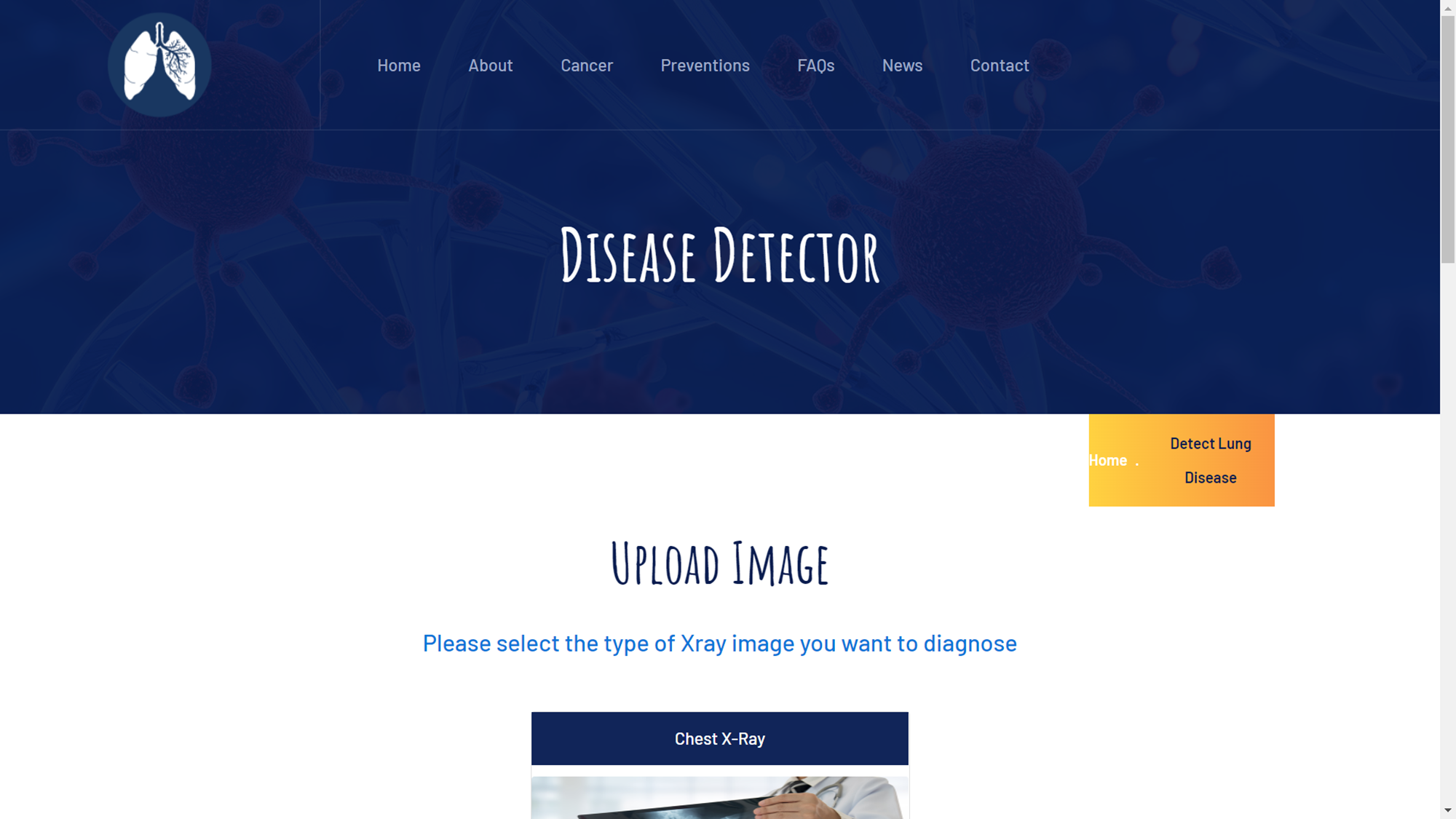 GitHub - prateek6391/EPICS-Lung-Disease-Prediction