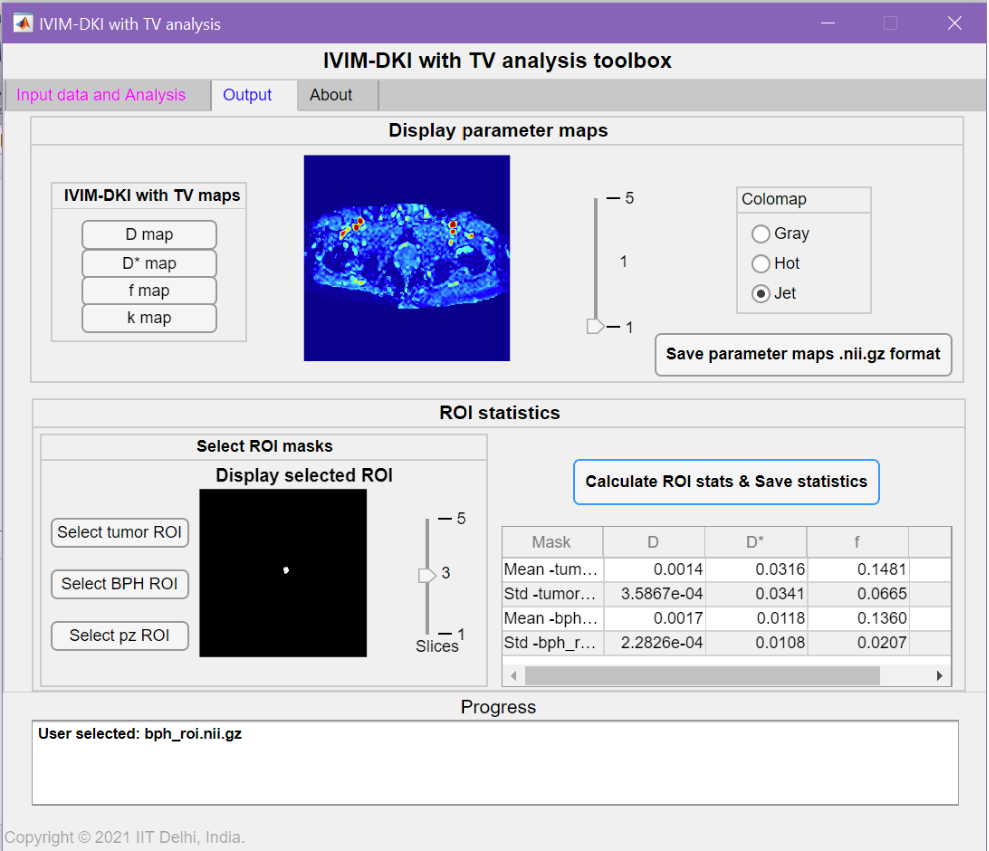 GitHub - AdamWu1979/IVIM-DKI-MRMP2021: A package providing MATLAB programming tools for IVIM-DKI ...