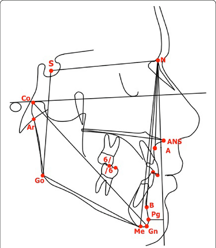 GitHub - mounesi/CephalometricAnalysisTool: The provided sample points in the script are ...