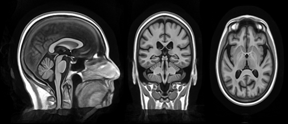 Skull-strip template image? · Issue #1311 · ANTsX/ANTs · GitHub