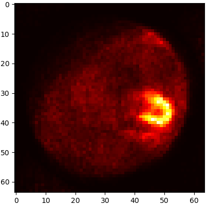 how use tomopy toolbox to reconstruct the image of the sinogram prepared from the device to ...
