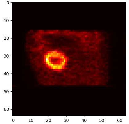 how use tomopy toolbox to reconstruct the image of the sinogram ...