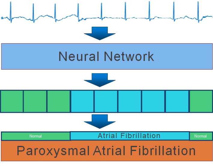 GitHub - CEllmemichael/Block-Pyramid-Network-paroxysmal-atrial ...