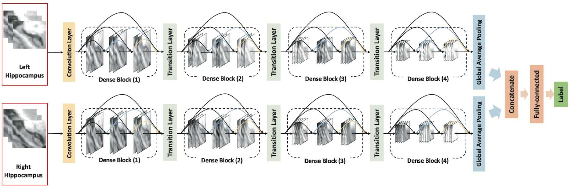 GitHub - rlckd/hippocampal-Dense: 3D DenseNet for hippocampal region