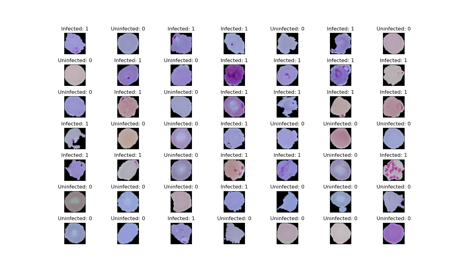GitHub - metehannguzel/malaria-cell-detection-cnn