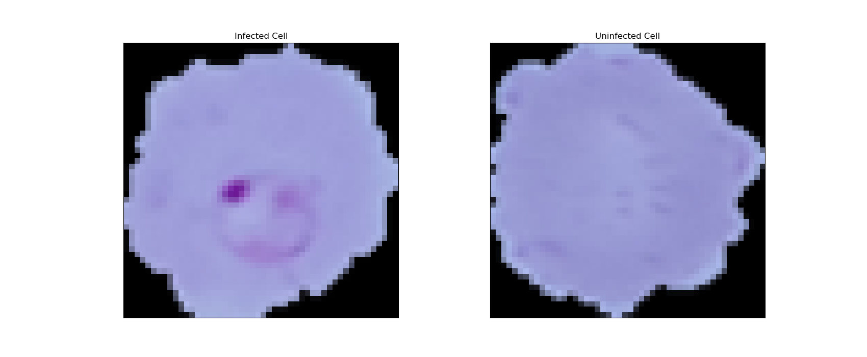 Github Metehannguzel Malaria Cell Detection Cnn