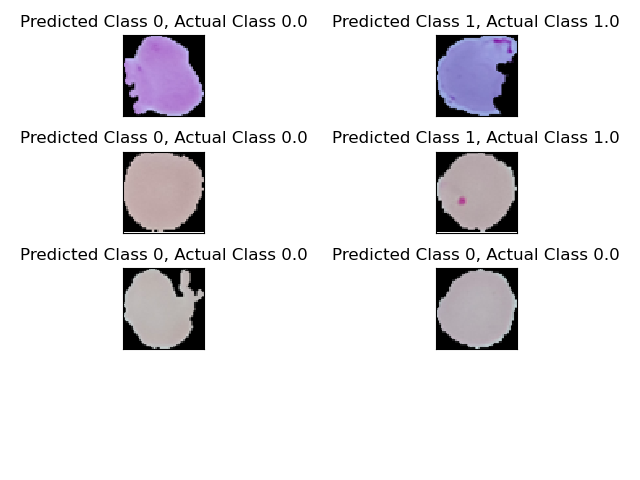GitHub - metehannguzel/malaria-cell-detection-cnn