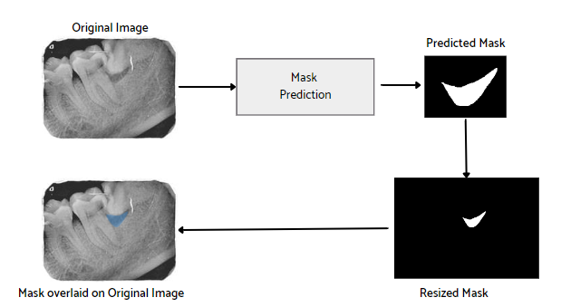 GitHub - anumfatima427/Dental-Caries-Segmentation: This repository contains code for generating ...