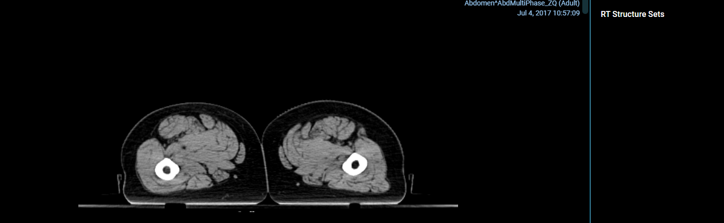 RTSTRUCT dicom file with local failed · Issue #2754 · OHIF/Viewers · GitHub