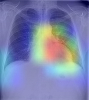 GitHub - Mithul-Joseph/Pathology-Detection