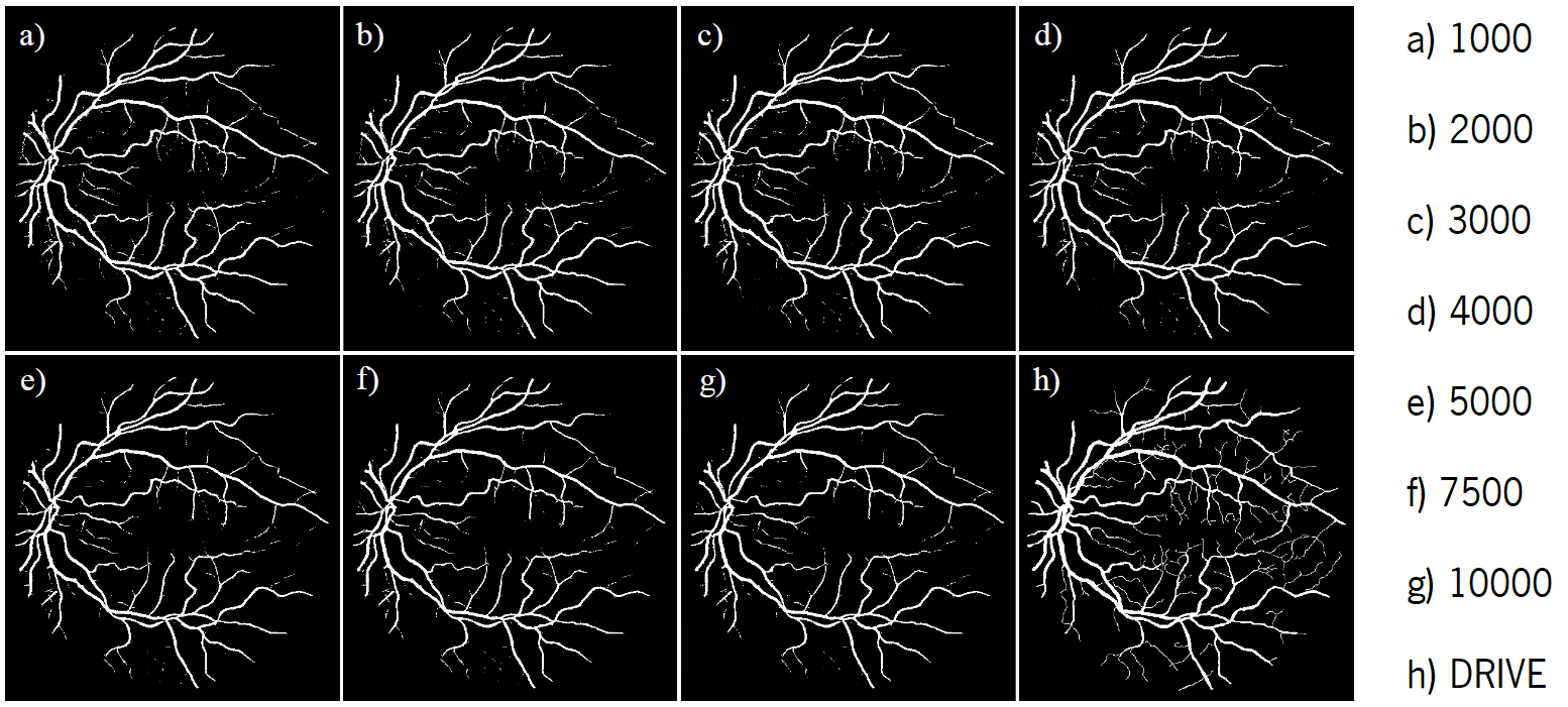 GitHub - MiguelCastro3/Different-classifiers-in-retinal-vessel-segmentation