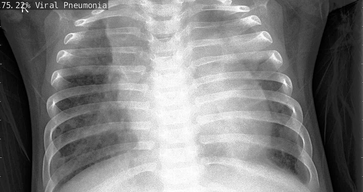 GitHub - CoolTechProjects/NvidiaJetson: Machine Learning Model Applied ...