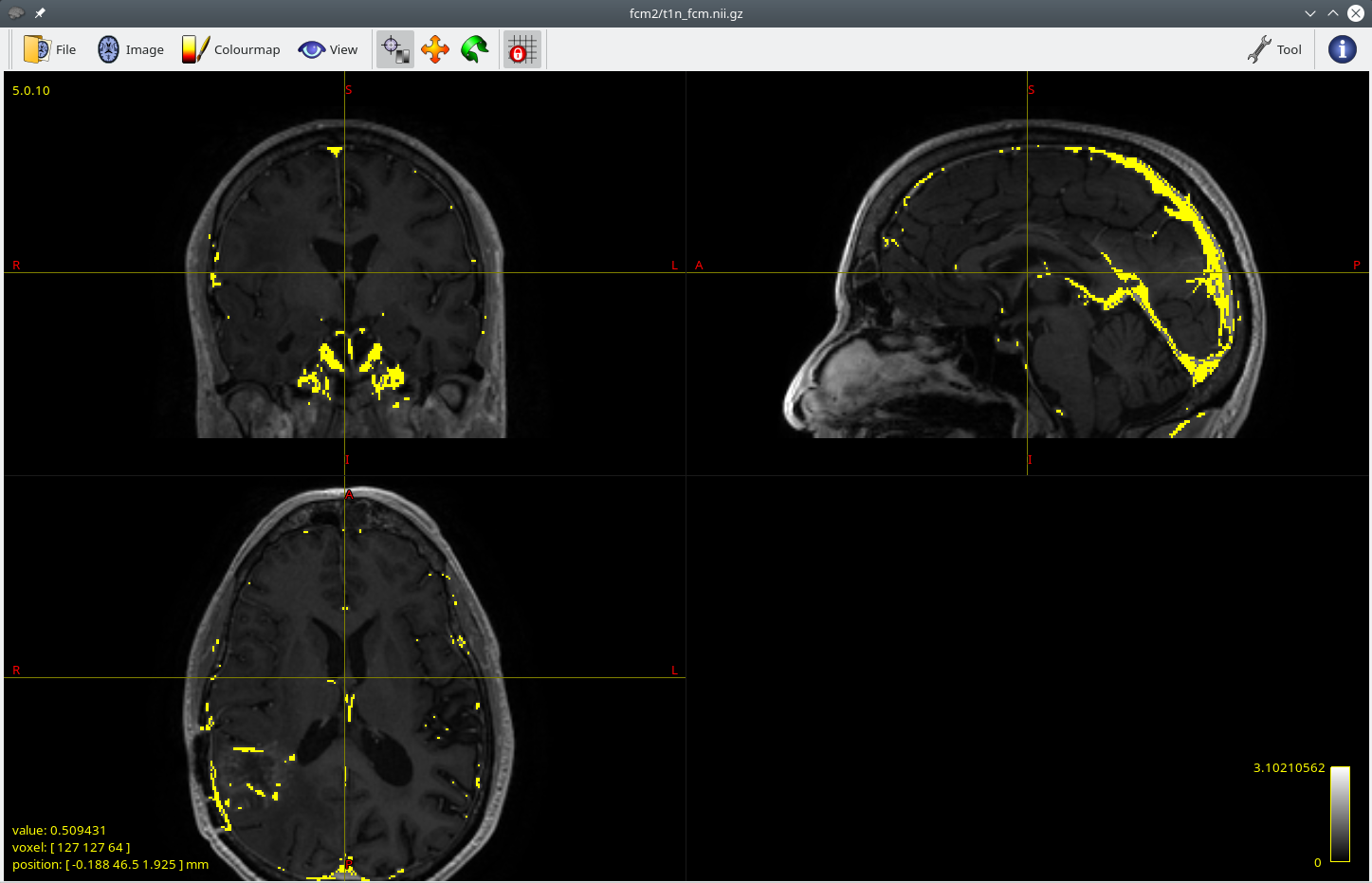 Path issue in command line execution · Issue #8 · jcreinhold/intensity-normalization · GitHub