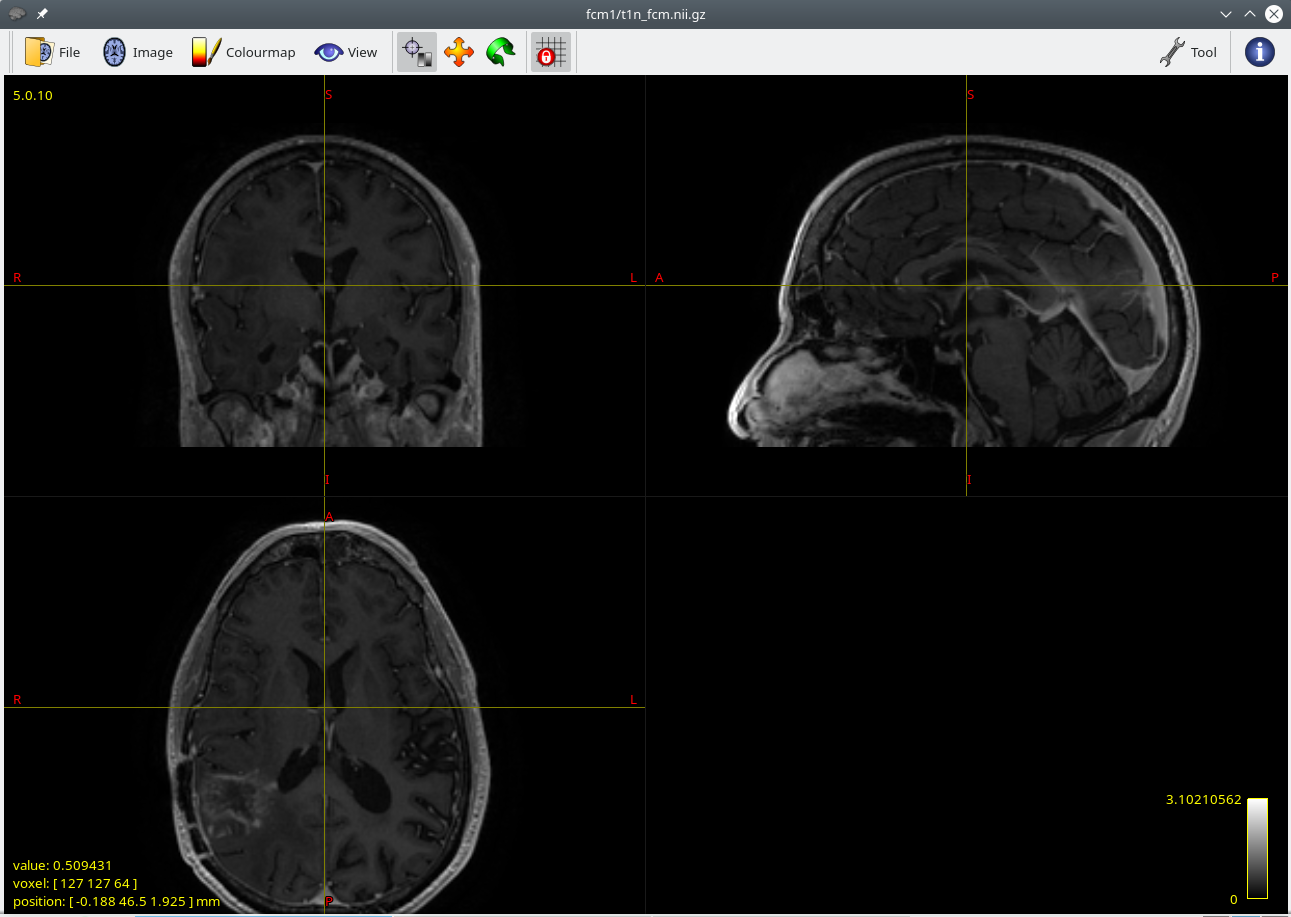 Path issue in command line execution · Issue #8 · jcreinhold/intensity-normalization · GitHub