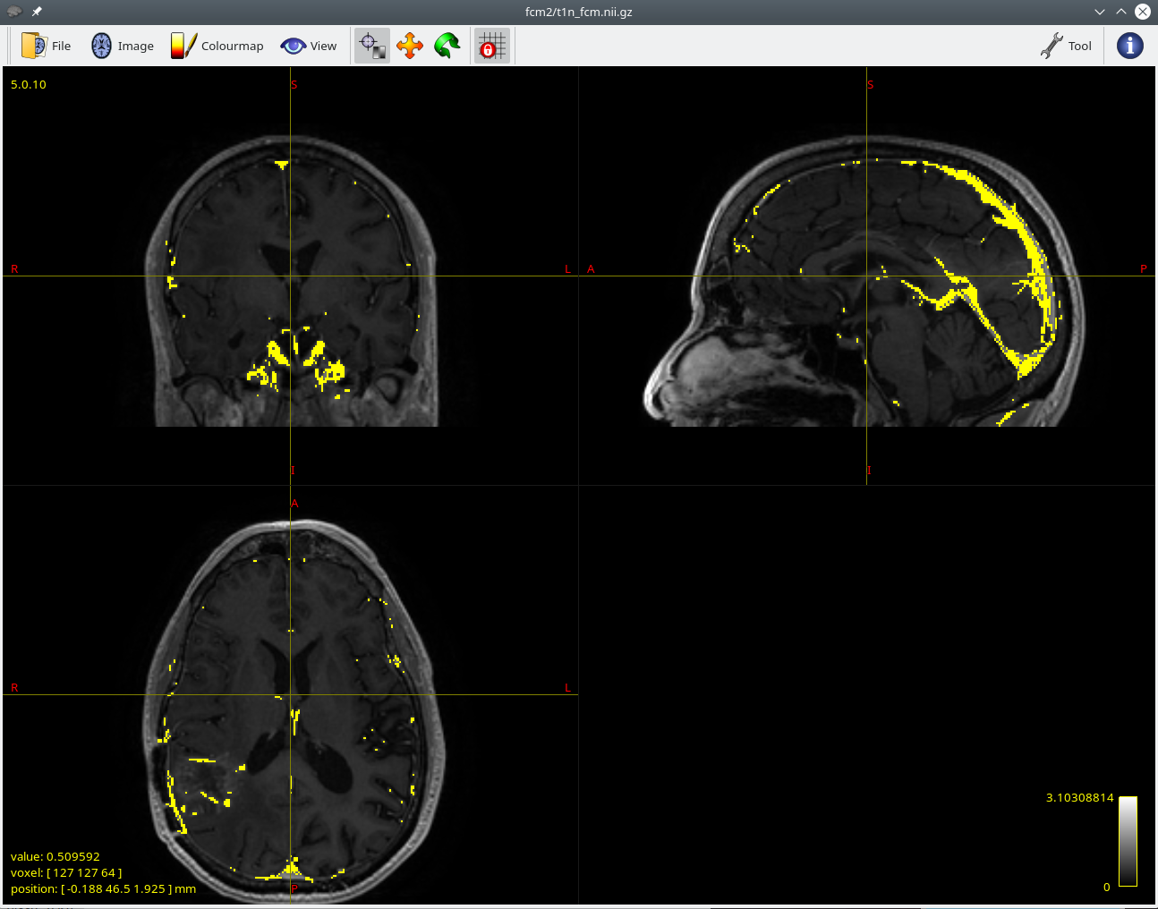 Path issue in command line execution · Issue #8 · jcreinhold/intensity-normalization · GitHub
