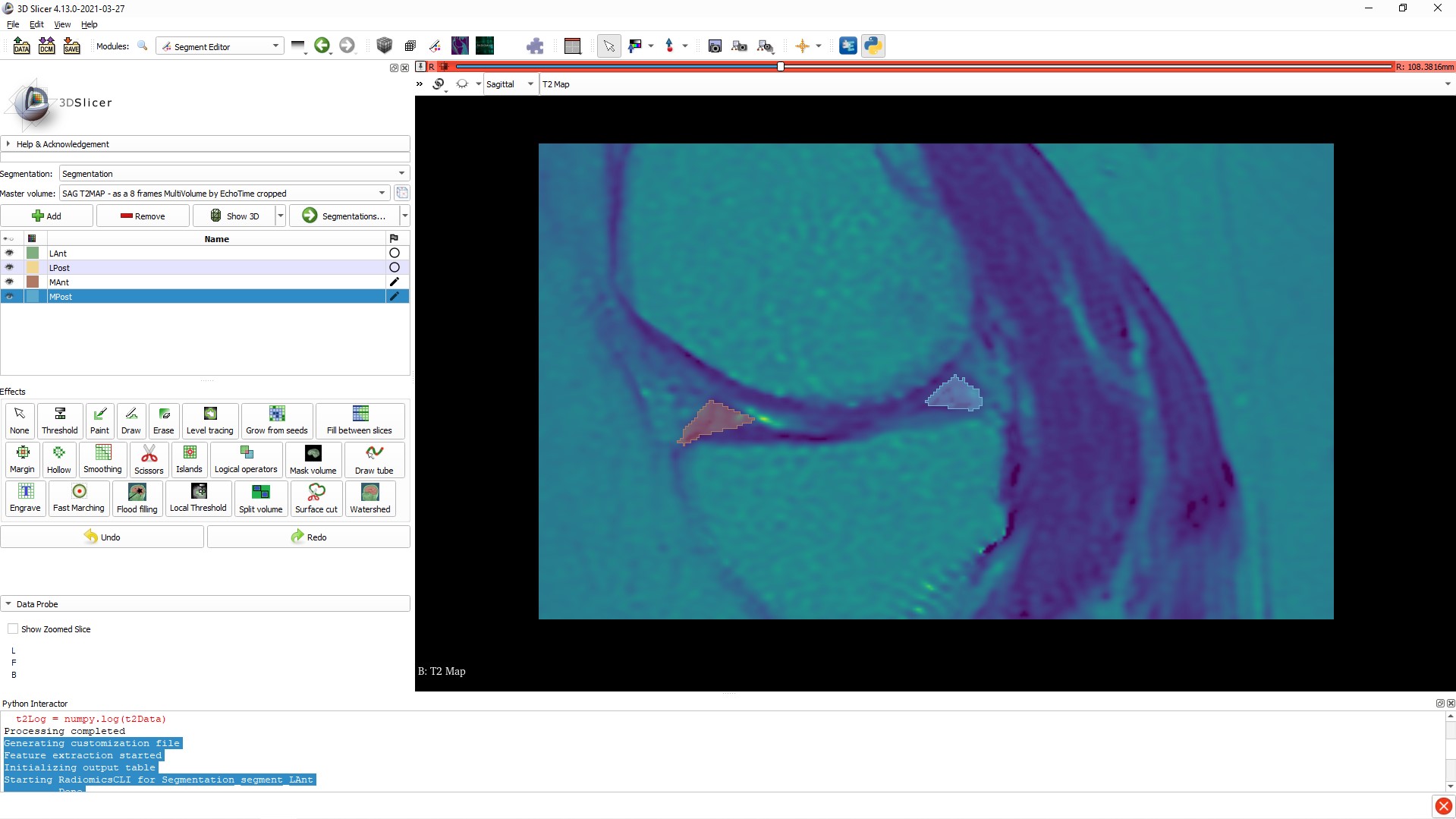 3D Slicer computation error[BUG] · Issue #688 · AIM-Harvard/pyradiomics · GitHub