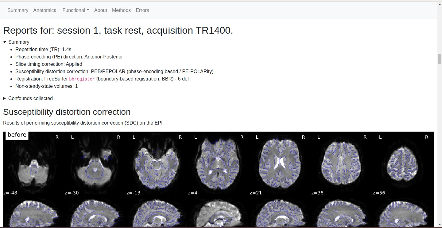 Estimated fieldmap and alignment to the corresponding EPI reference · Issue #2225 · nipreps ...