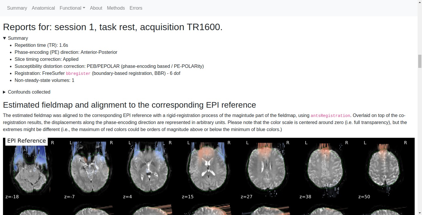 Estimated fieldmap and alignment to the corresponding EPI reference · Issue #2225 · nipreps ...