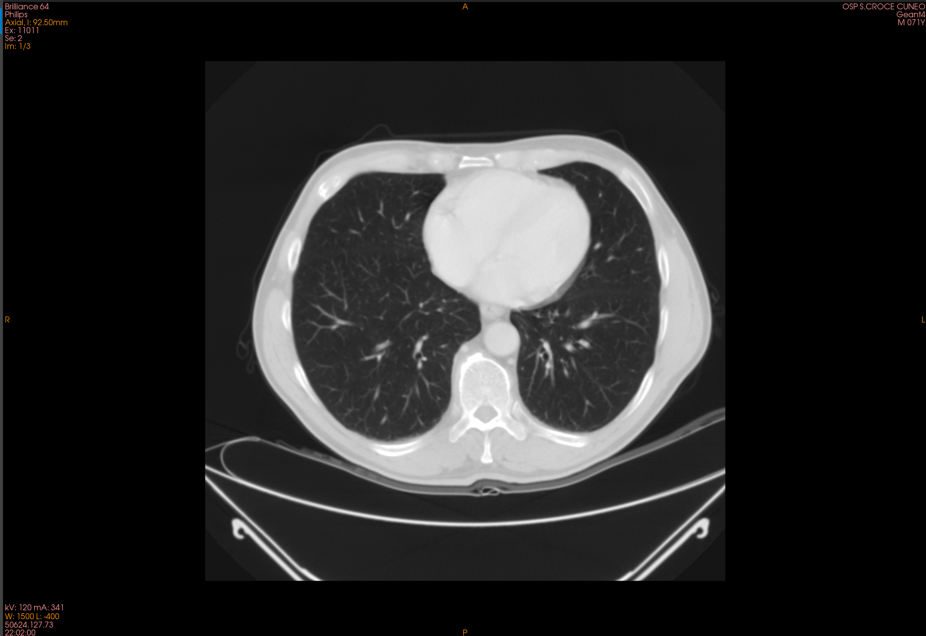 DICOM input error · Issue #437 · e0404/matRad · GitHub