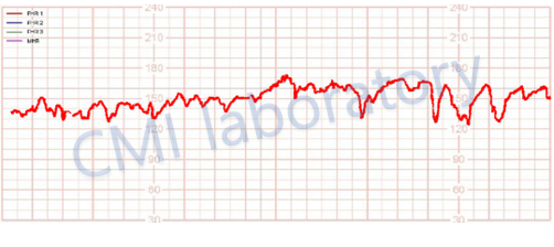 GitHub - CMI-Laboratory/Fetal_cardiotocography_extract_code