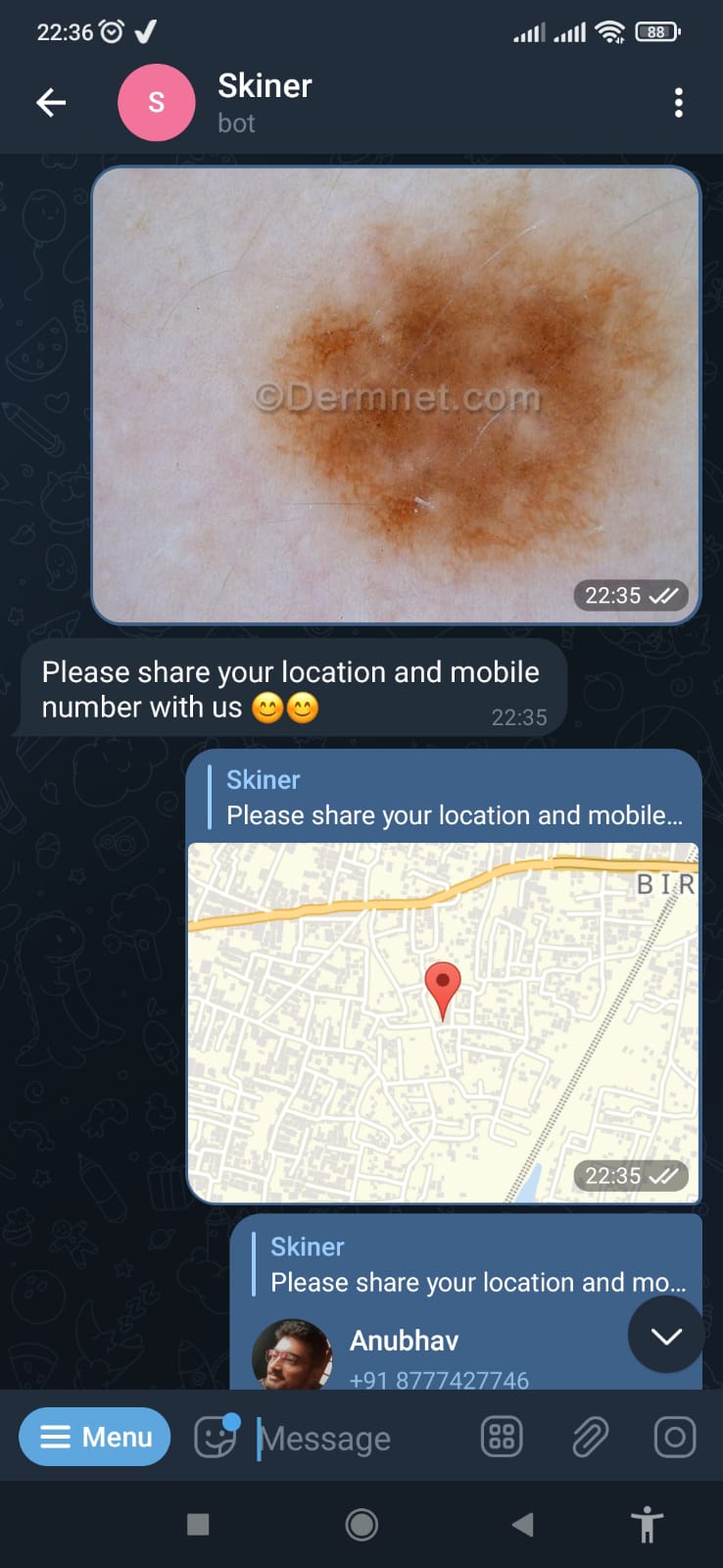 GitHub - Anubhav068/Skin-Disease-Detection-Telegram-Bot-Skiner-: This ...