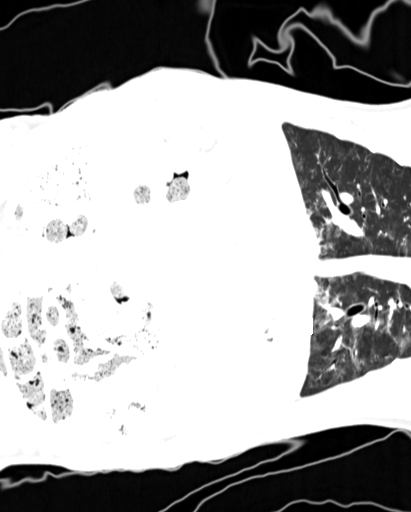 Unexpected DRR orientation · Issue #99 · arcadelab/deepdrr · GitHub