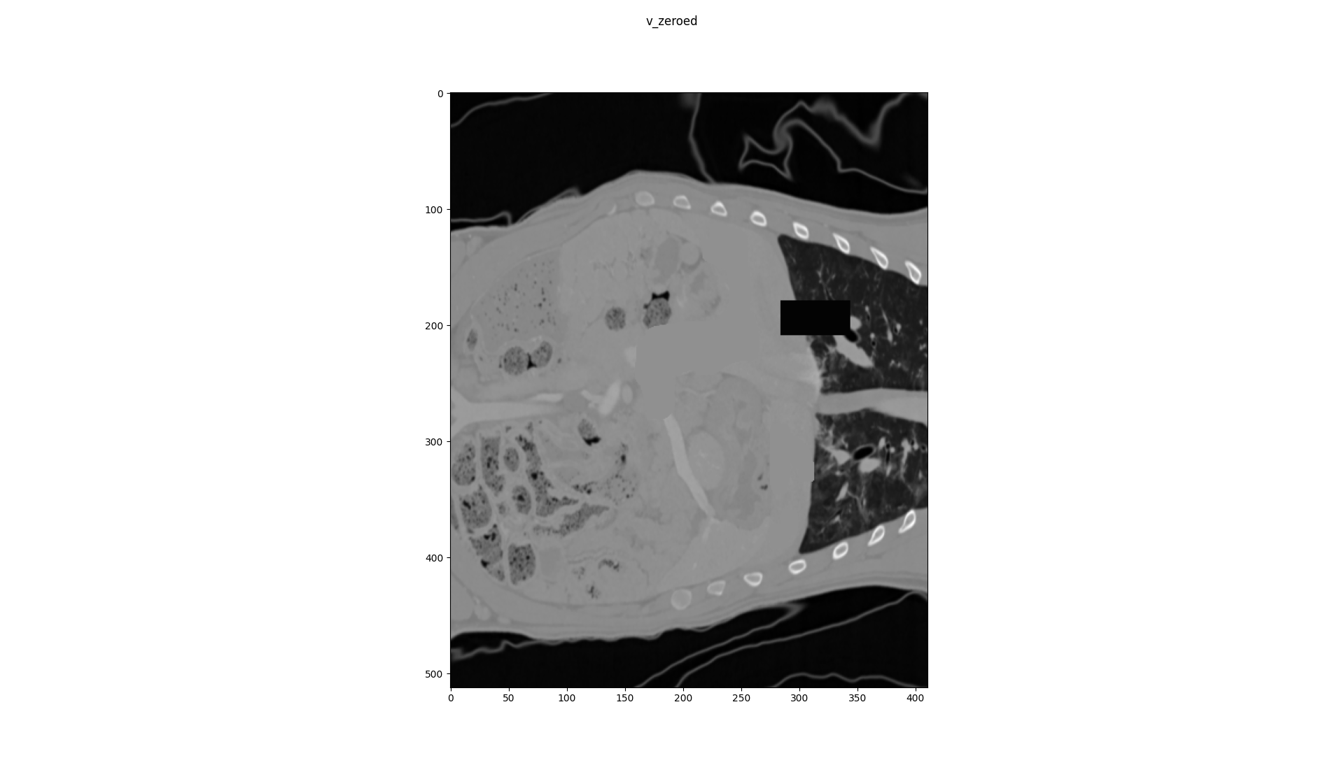 Unexpected DRR orientation · Issue #99 · arcadelab/deepdrr · GitHub