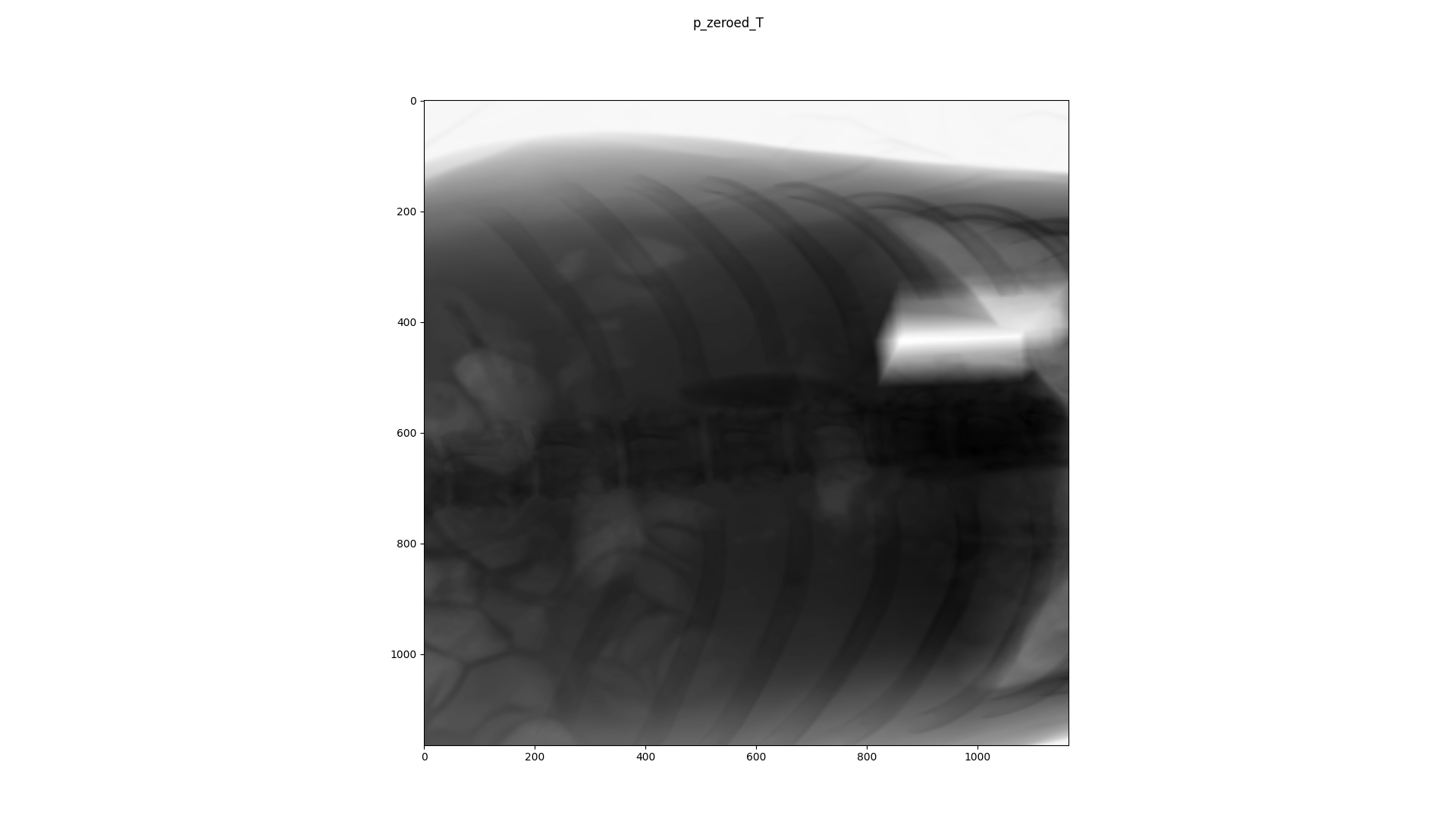 Unexpected DRR orientation · Issue #99 · arcadelab/deepdrr · GitHub