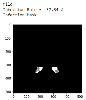 GitHub - 02Ankit/CT-Scan-Segmentation-and-Reconstruction