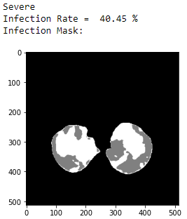 GitHub - 02Ankit/CT-Scan-Segmentation-and-Reconstruction