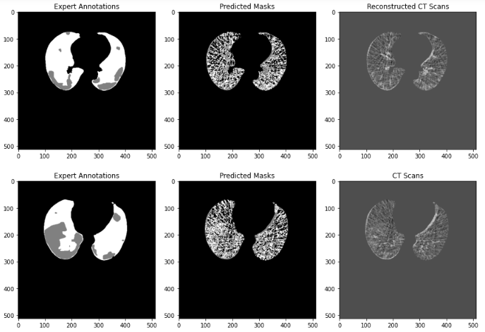 GitHub - 02Ankit/CT-Scan-Segmentation-and-Reconstruction